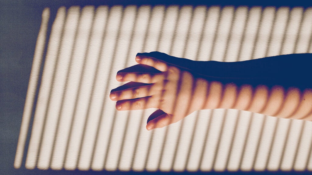 Spitz nevus: Pictures, diagnosis, and treatment