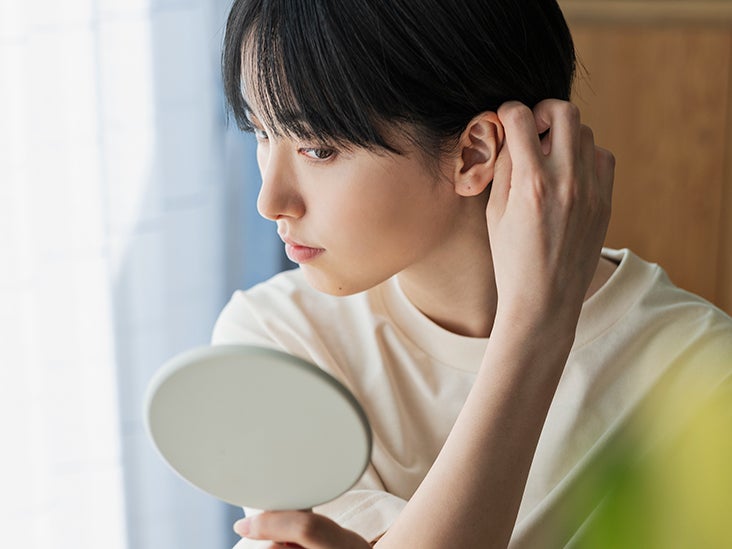 Psoriasis in the ears: Treatment and symptoms