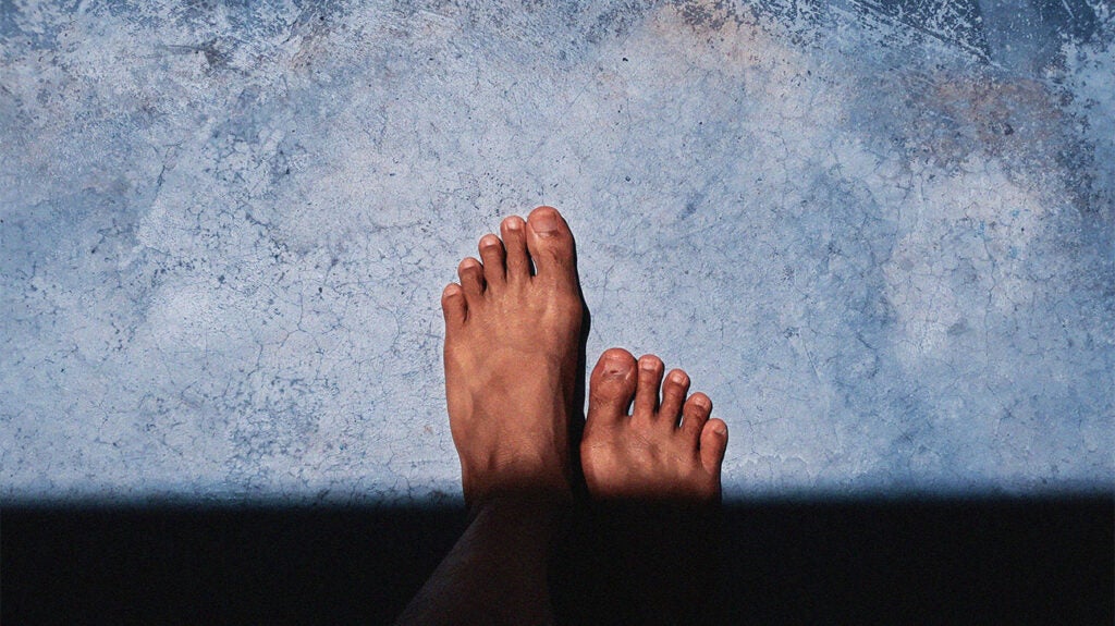 Palmoplantar psoriasis: Causes, symptoms, and treatment