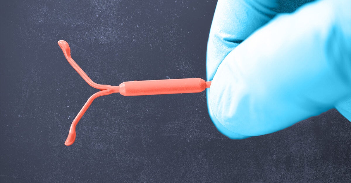 IUD for endometriosis: Benefits and side effects