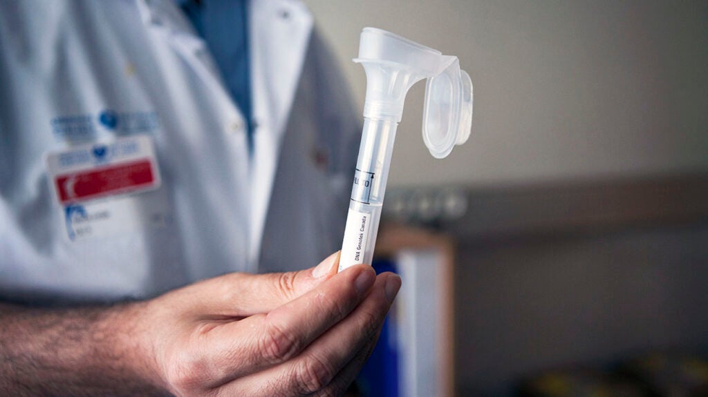 PCA3 test for prostate cancer: What you need to know