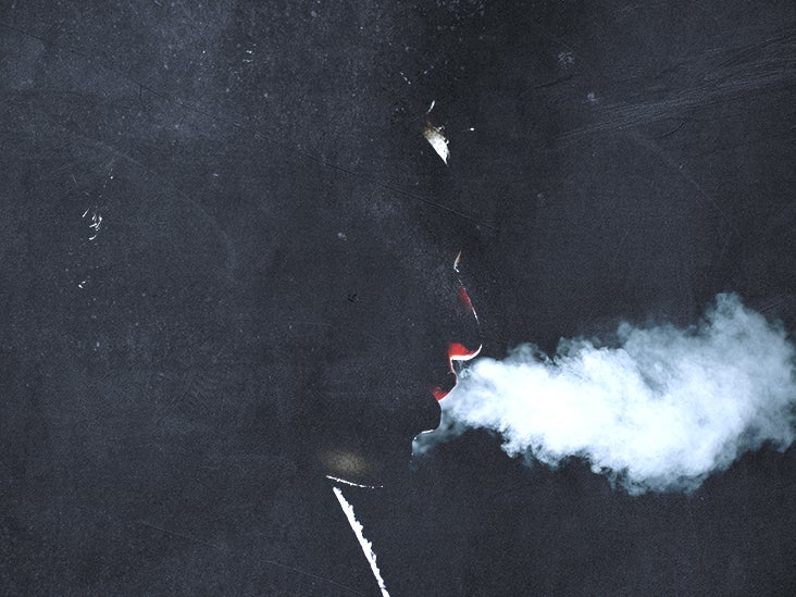 COPD hypoxia: Causes, symptoms, and treatment