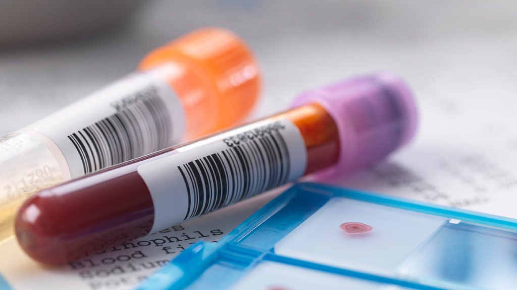 Erythropoietin: Definition, function, and tests