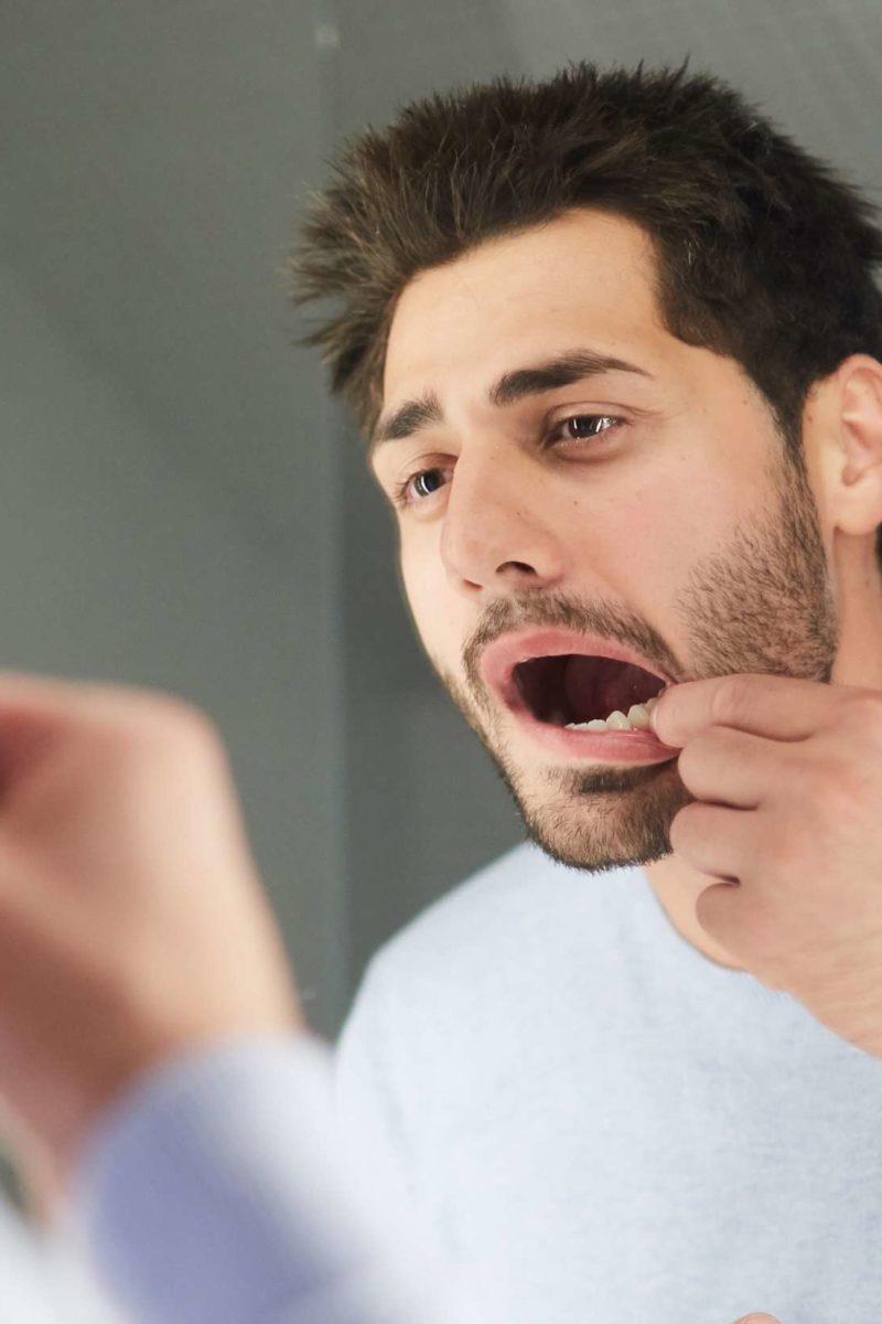 Soft palate: Anatomical diagram, function, and injuries