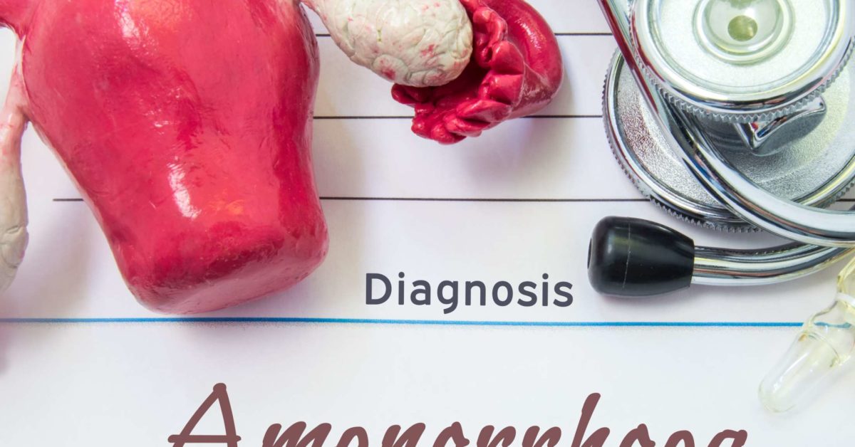 Amenorrhea: Types, causes, and treatment