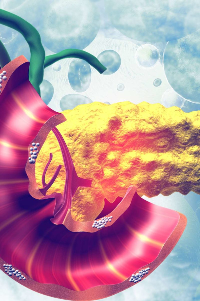 Artificial pancreas for type 1 diabetes could reach patients by 2018