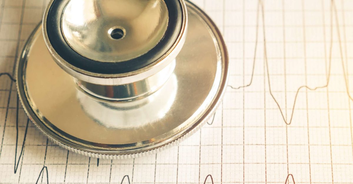 Torsades de pointes: Treatment, symptoms, and causes