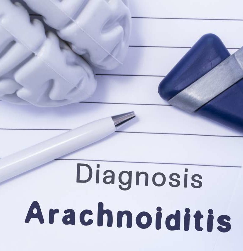 Arachnoiditis: Symptoms, types, causes, and treatment