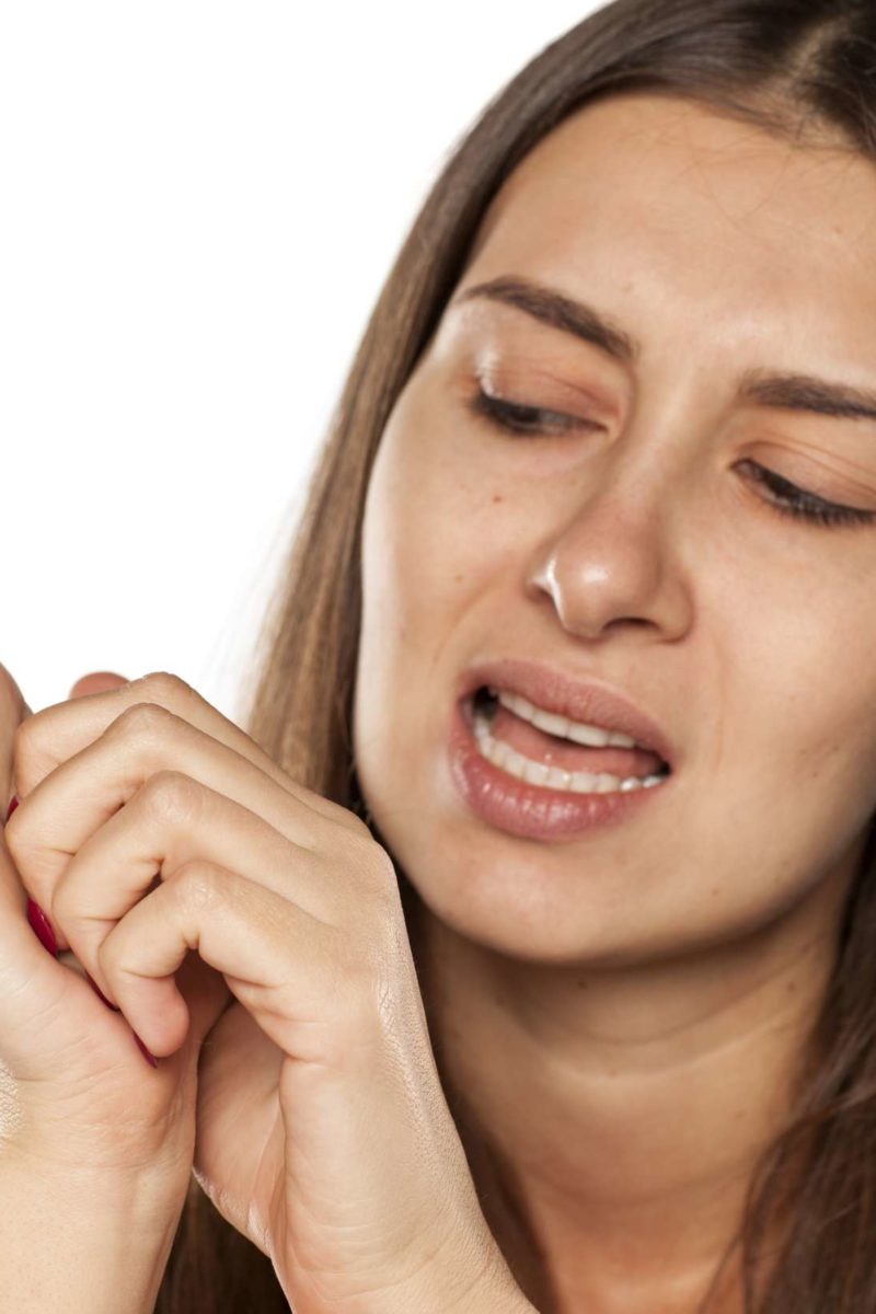 Palmoplantar pustulosis: Symptoms, causes, and treatment