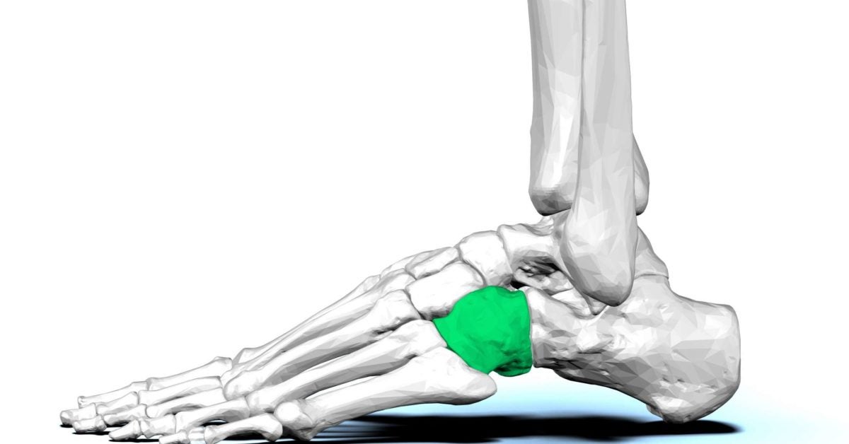 Cuboid Syndrome What It Is Treatment And Recovery
