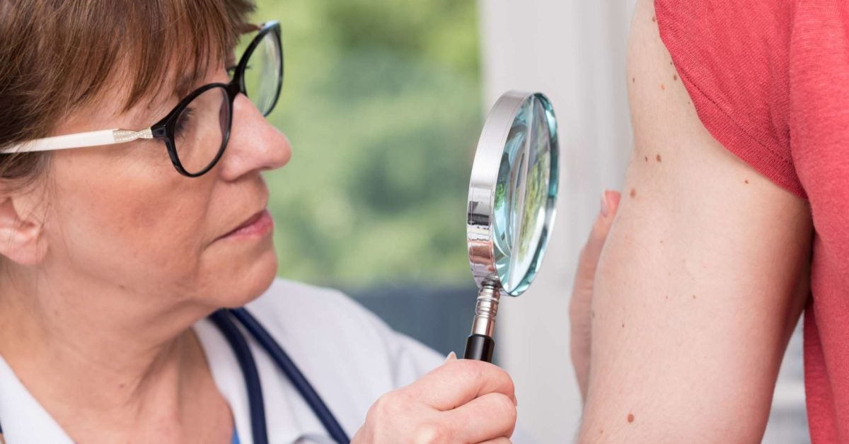 Angiolipoma: Definition, causes, and treatment