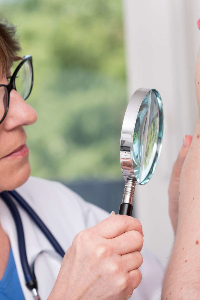 Angiolipoma: Definition, causes, and treatment