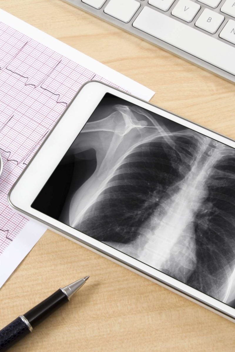 Centrilobular emphysema: Diagnosis, treatment, and outlook