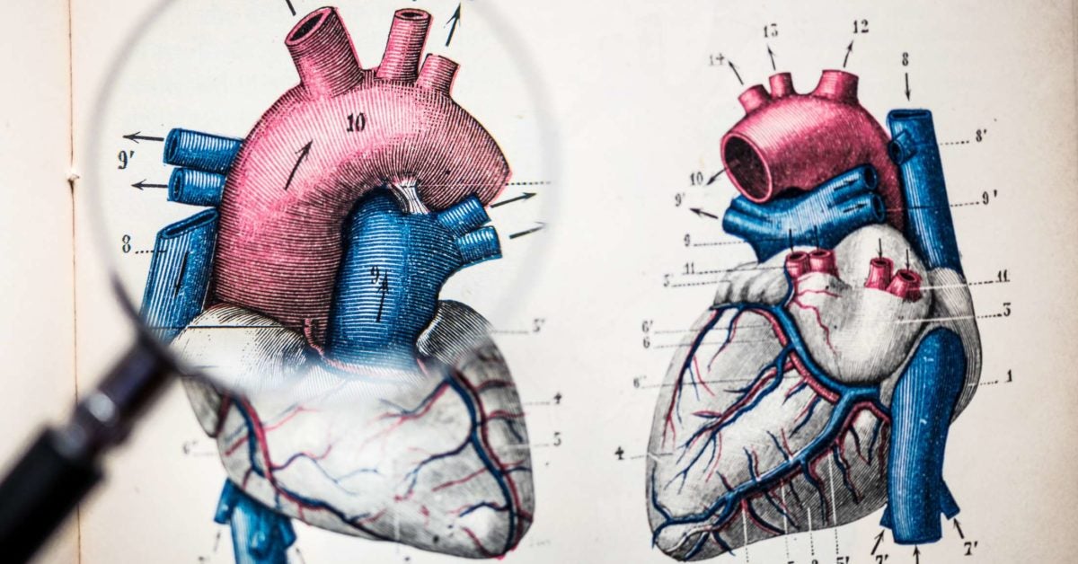 What can autopsies teach us about heart disease?