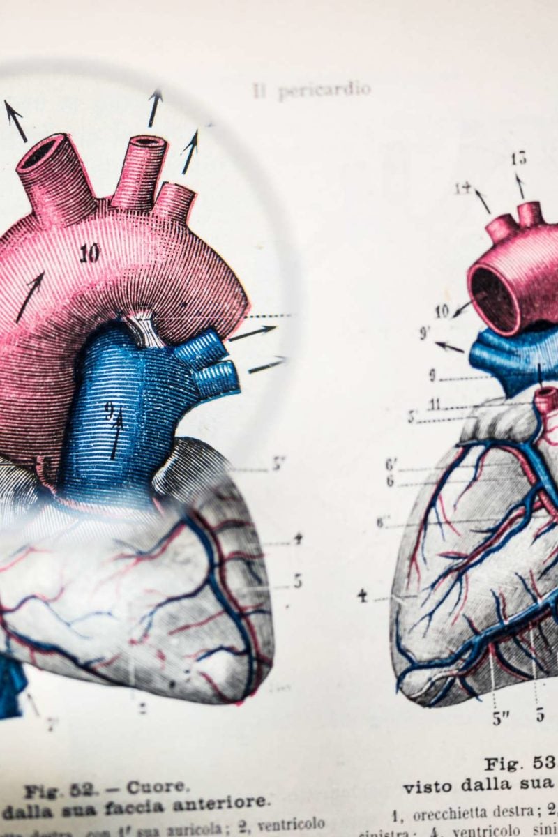 What can autopsies teach us about heart disease?