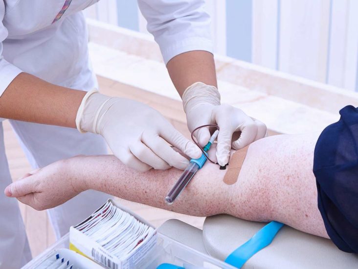 Eos auto lab test - powenswim