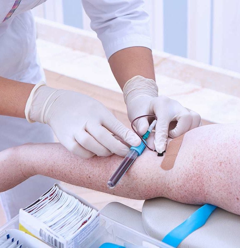 Eosinophil count: Test and results