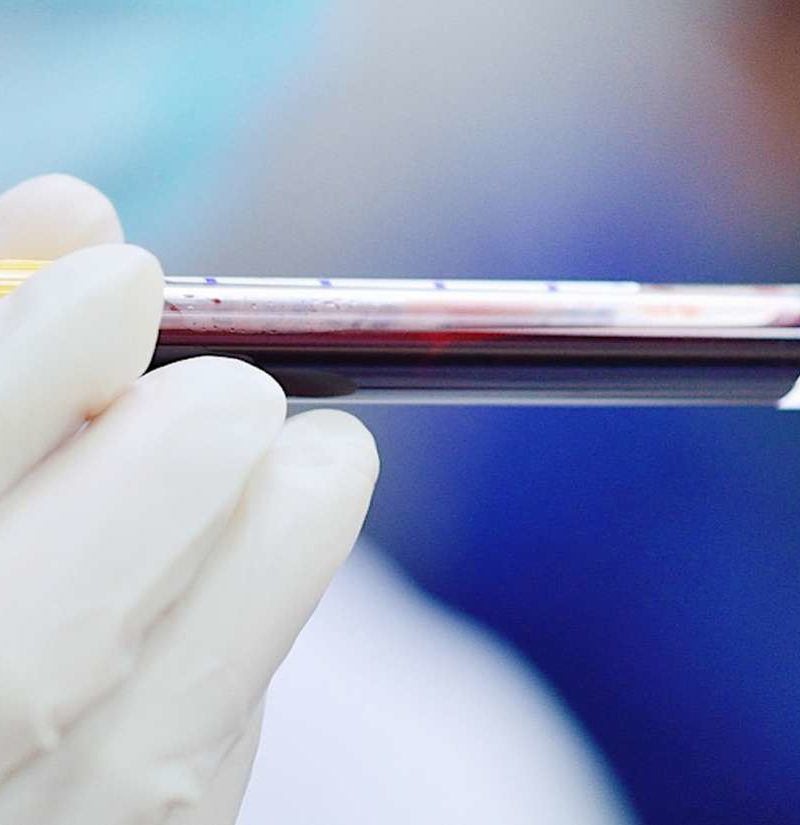 Luteinizing hormone (LH) test: Uses, ranges, and results