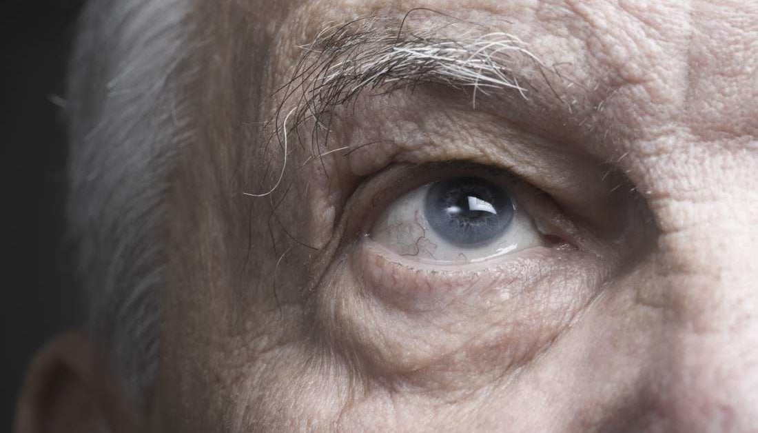 Stroke Rewiring Eye brain Connection May Restore Vision