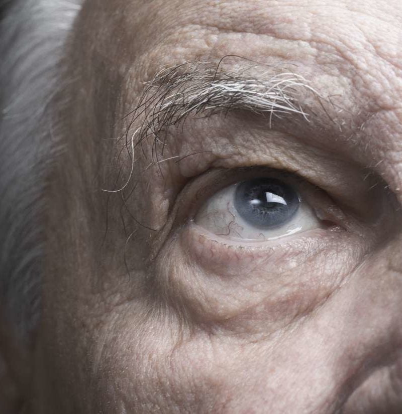 Stroke Rewiring Eye brain Connection May Restore Vision Stroke Rewiring Eye brain Connection May Restore Vision