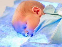 Psoriasis in babies: Symptoms and treatment