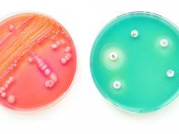 Loss of microbial gut diversity a threat to health?