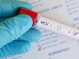 How is hepatitis C transmitted?
