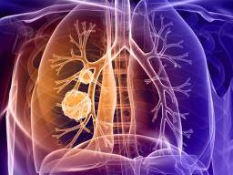 Single molecule determines lung cancer cell death