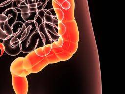 Left-sided colitis: Symptoms, diagnosis, and treatment