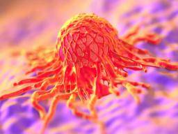 Protein identifies cancer cells becoming aggressive, ready to spread