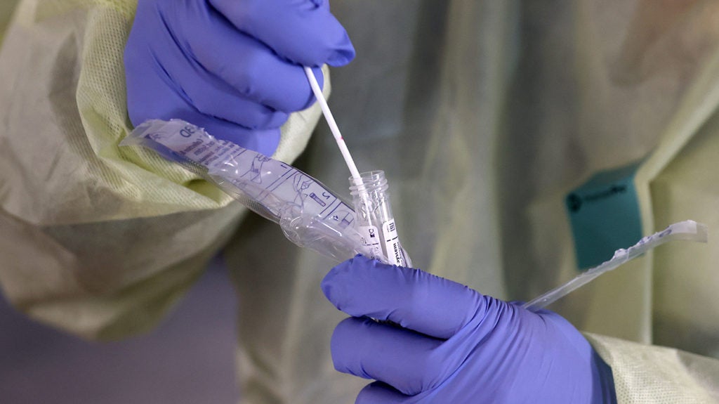 Coronavirus (COVID-19) tests: Methods, availability, and accuracy