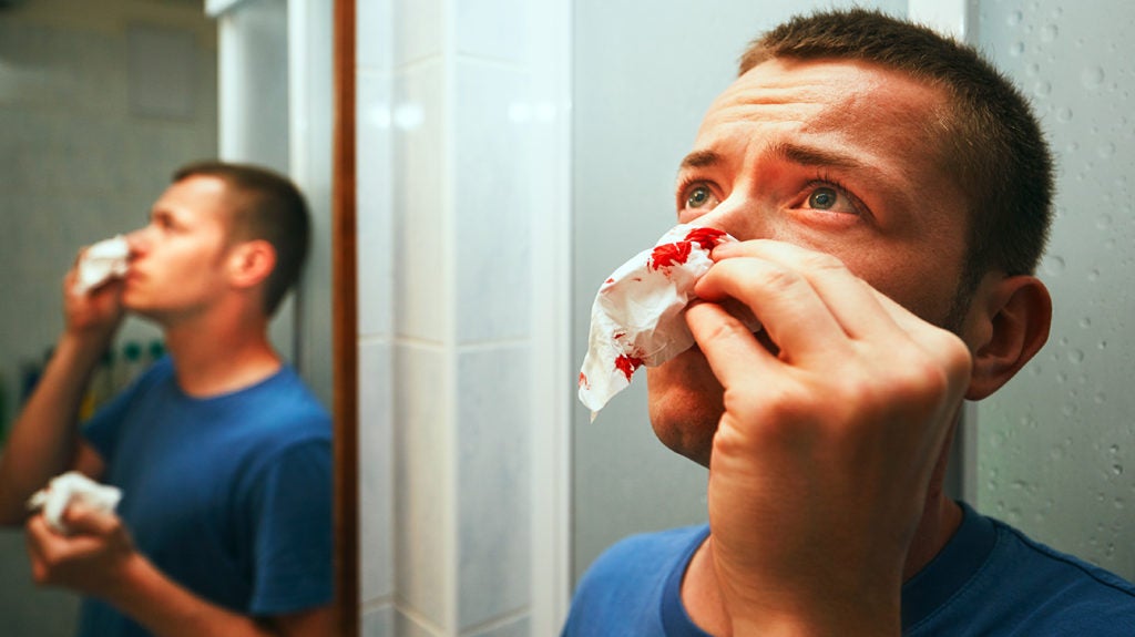 Daily nosebleeds: Causes and treatment