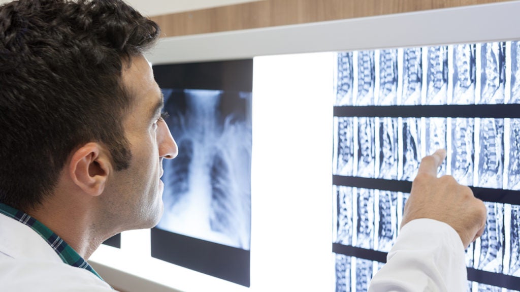 Complete vs incomplete spinal cord injury: What to know