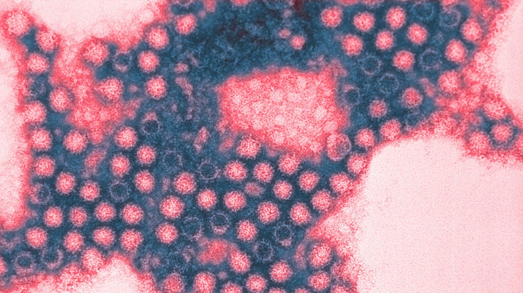 Pathogens: Definition, types, diseases, prevention, and more