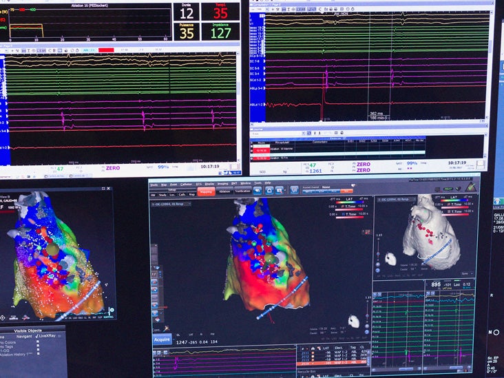 Cardiac ablation surgery: Types, risks, what to expect, and more