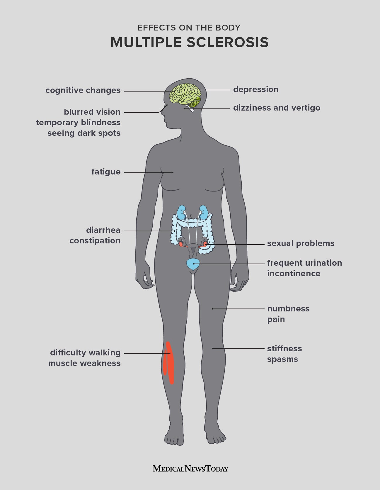 15 Symptoms Of Multiple Sclerosis MS In Women