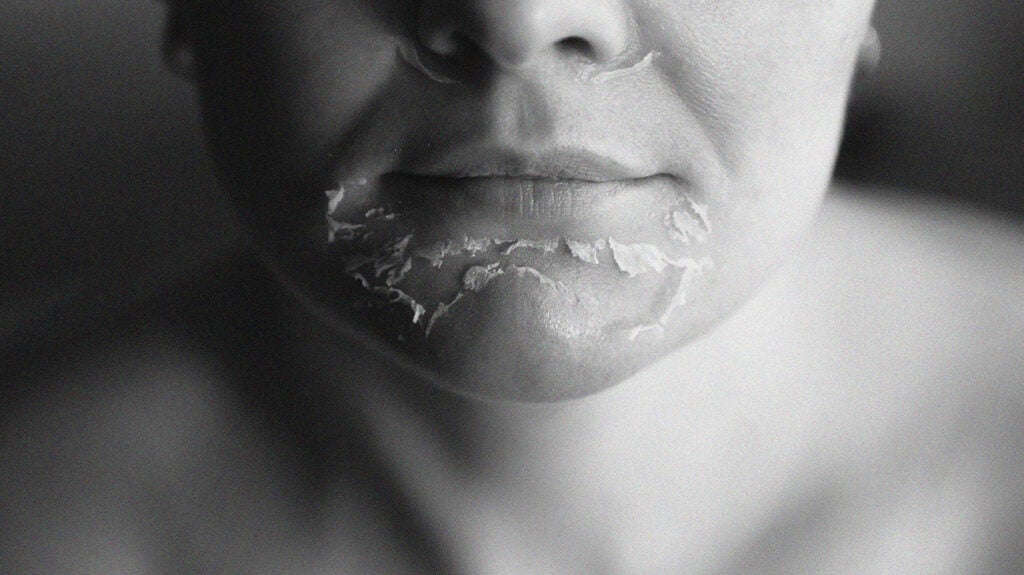 Dry skin: Causes, treatments, prevention, and more