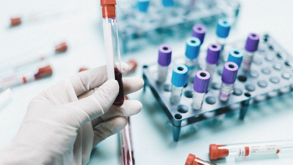 VLDL and LDL: What’s the difference, causes, treatments