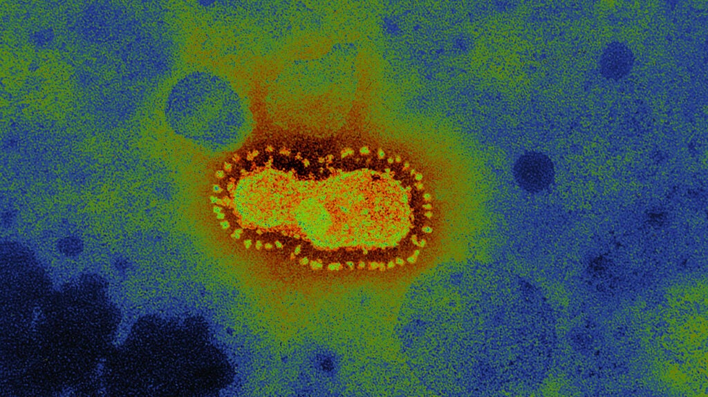 Human challenge studies: What are they, and how do they help?