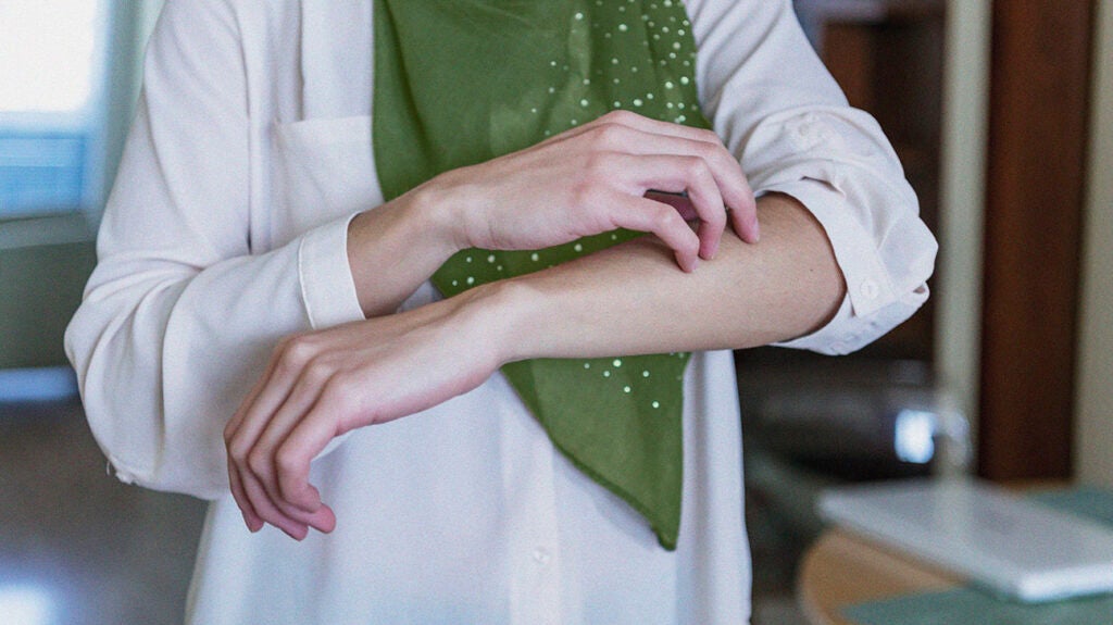 Polycythemia vera skin: What does it look like?