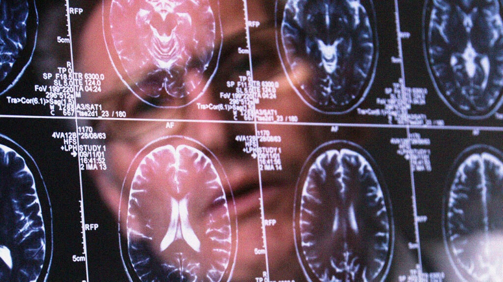 What are the 13 factors that shape brain health?