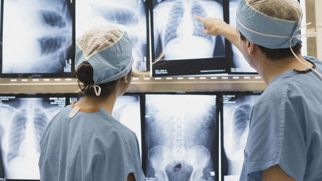 Ground glass opacity: Causes, symptoms, and treatments