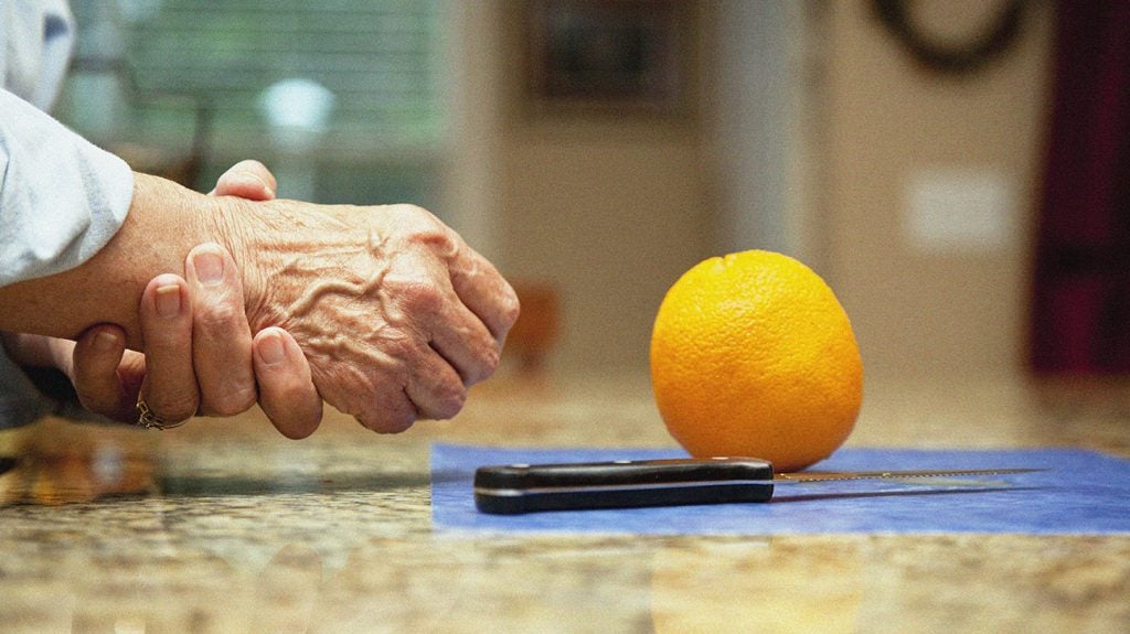 Parkinson's life expectancy: Stages and treatment options