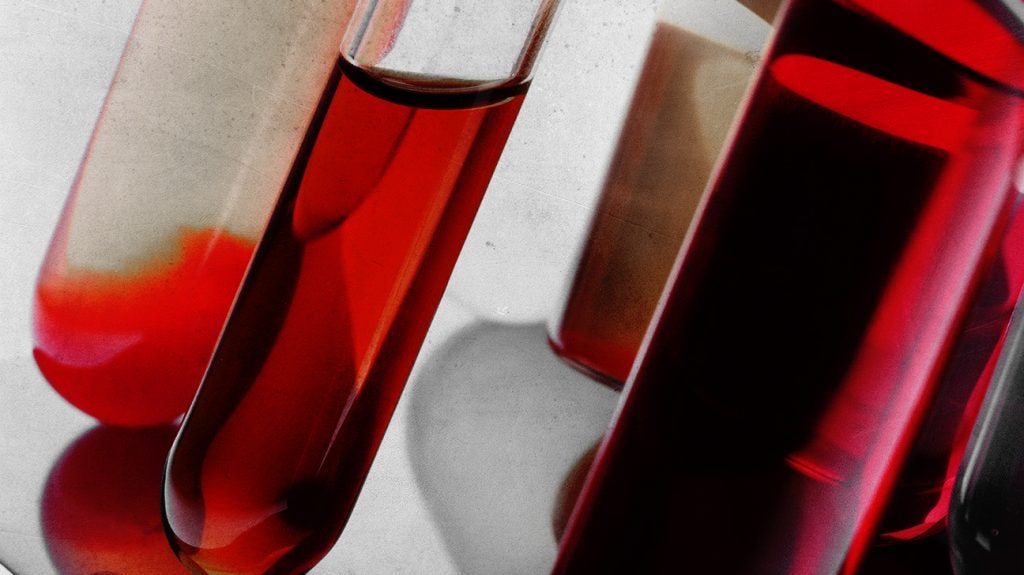 Hepatitis panel: What it involves, preparation, and results