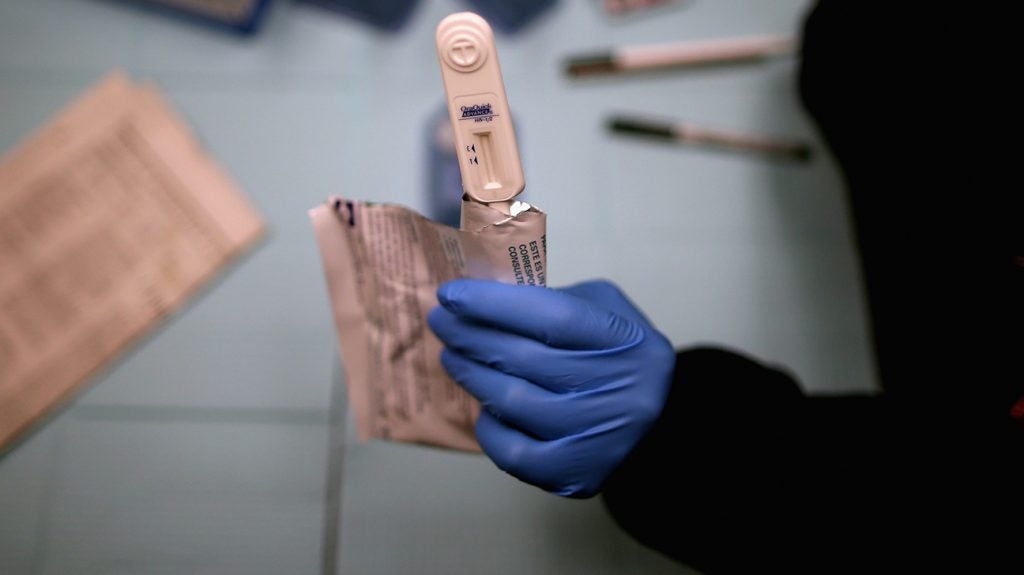 Rapid HIV test: Options, benefits, and more