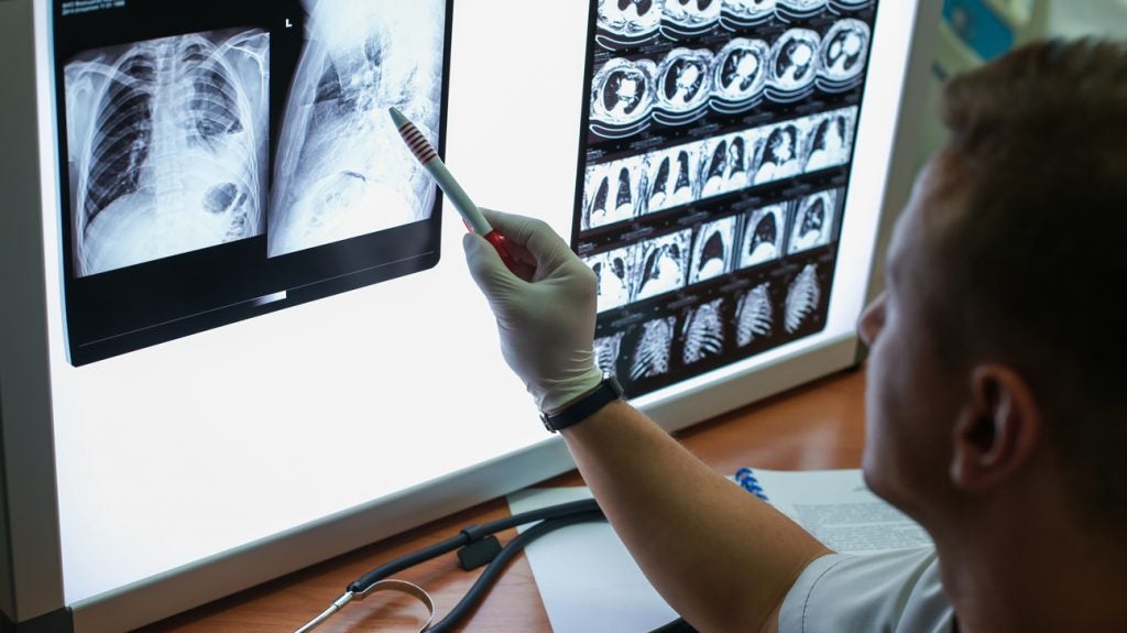 COPD lung sounds: Types, descriptions, treatment, and more
