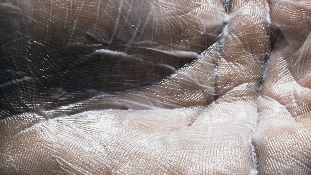 What causes eczema to flare up? 9 possible triggers