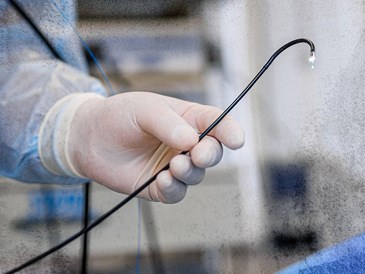 Ulcerative colitis endoscopy: What is it and more