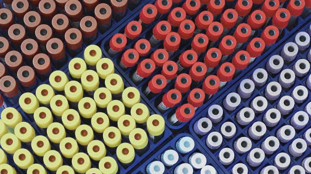 Hematocrit test: What it is, levels, high and low range