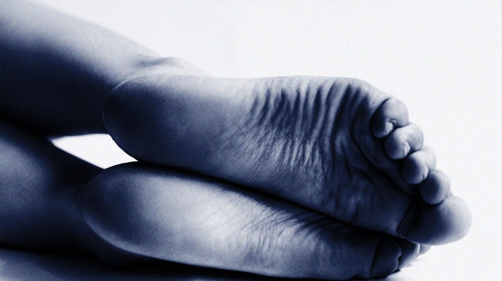 What does a seizure look like?